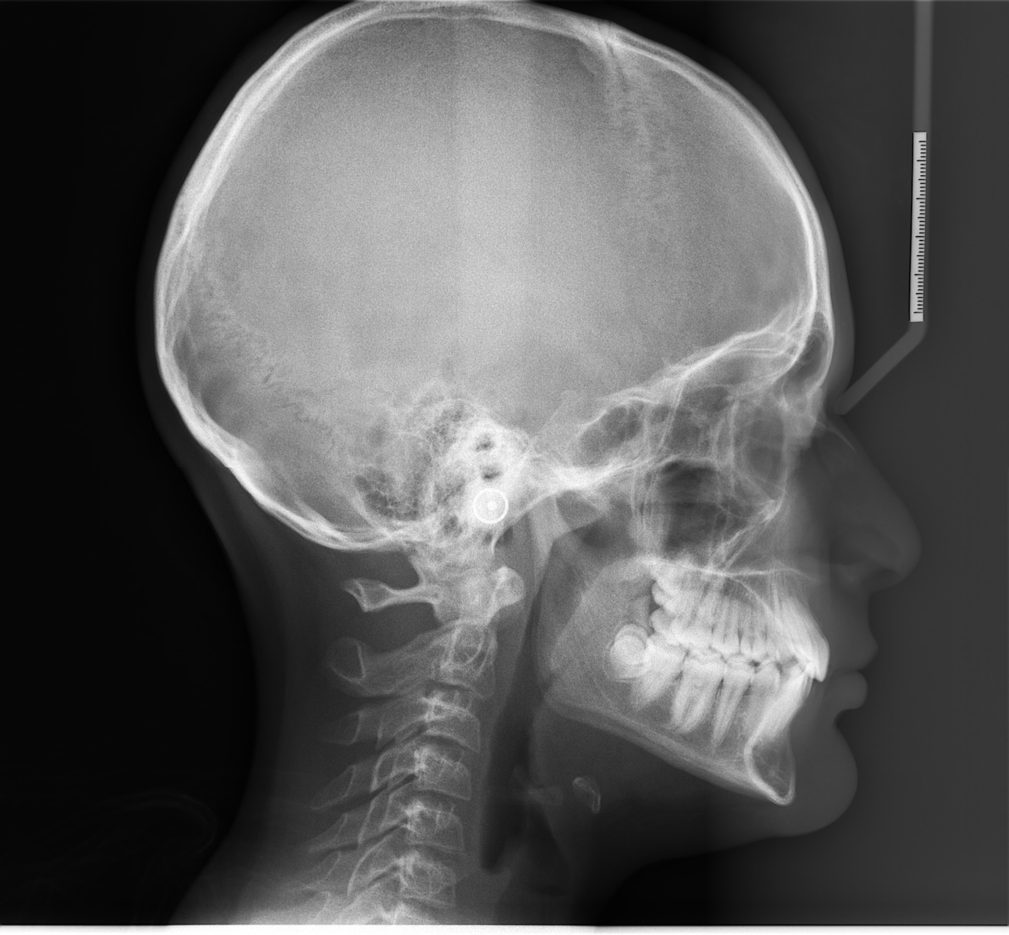 Our Advanced Technology | Walker Dixon Ortho